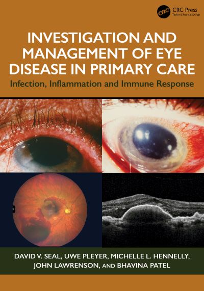 Investigation & Management of Eye Disease in Primary Care by David V ...