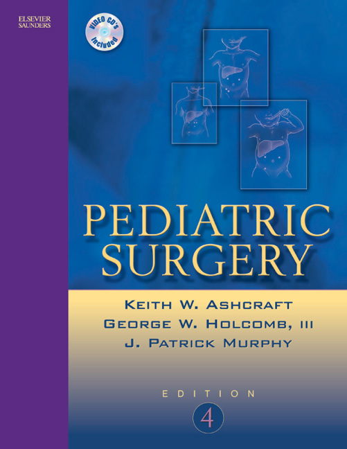 Pediatric surgery by Ashcraft, Keith W. (9780721602226) | BrownsBfS
