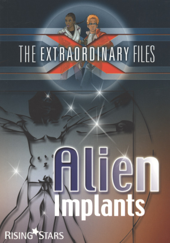 The Extraordinary Files: Alien Implants by Blum, Paul (9781846801815 ...