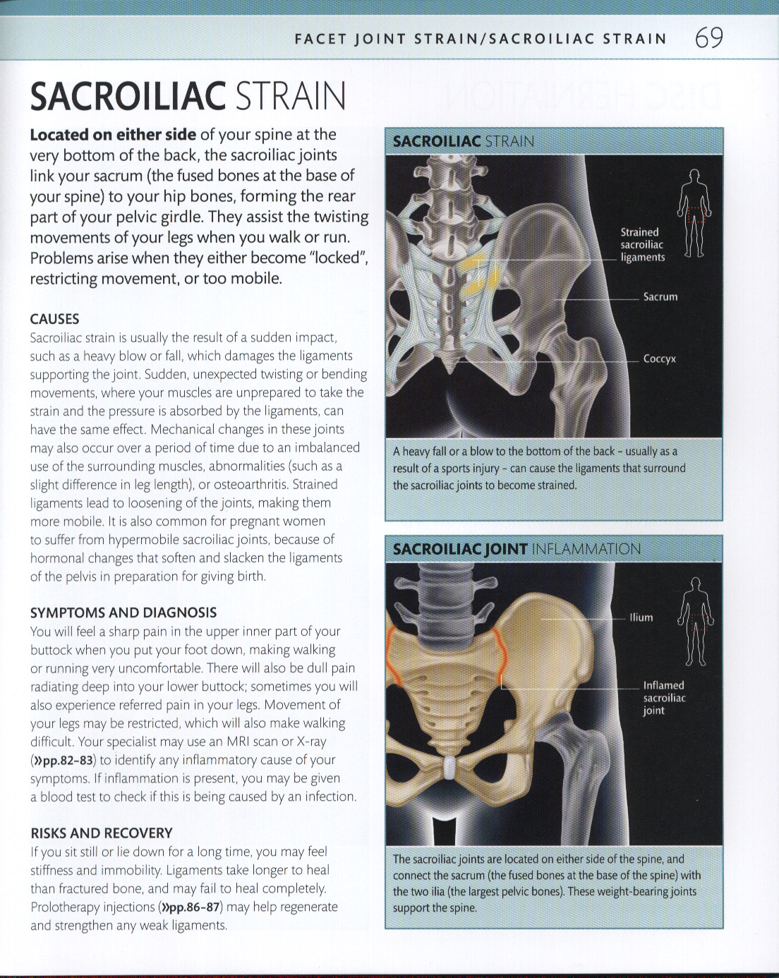 BMA Guide to Back Care by British Medical Association, (9781405364294 ...