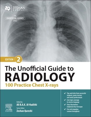 The unofficial guide to radiology.: (100 practice chest x-rays) by Al ...
