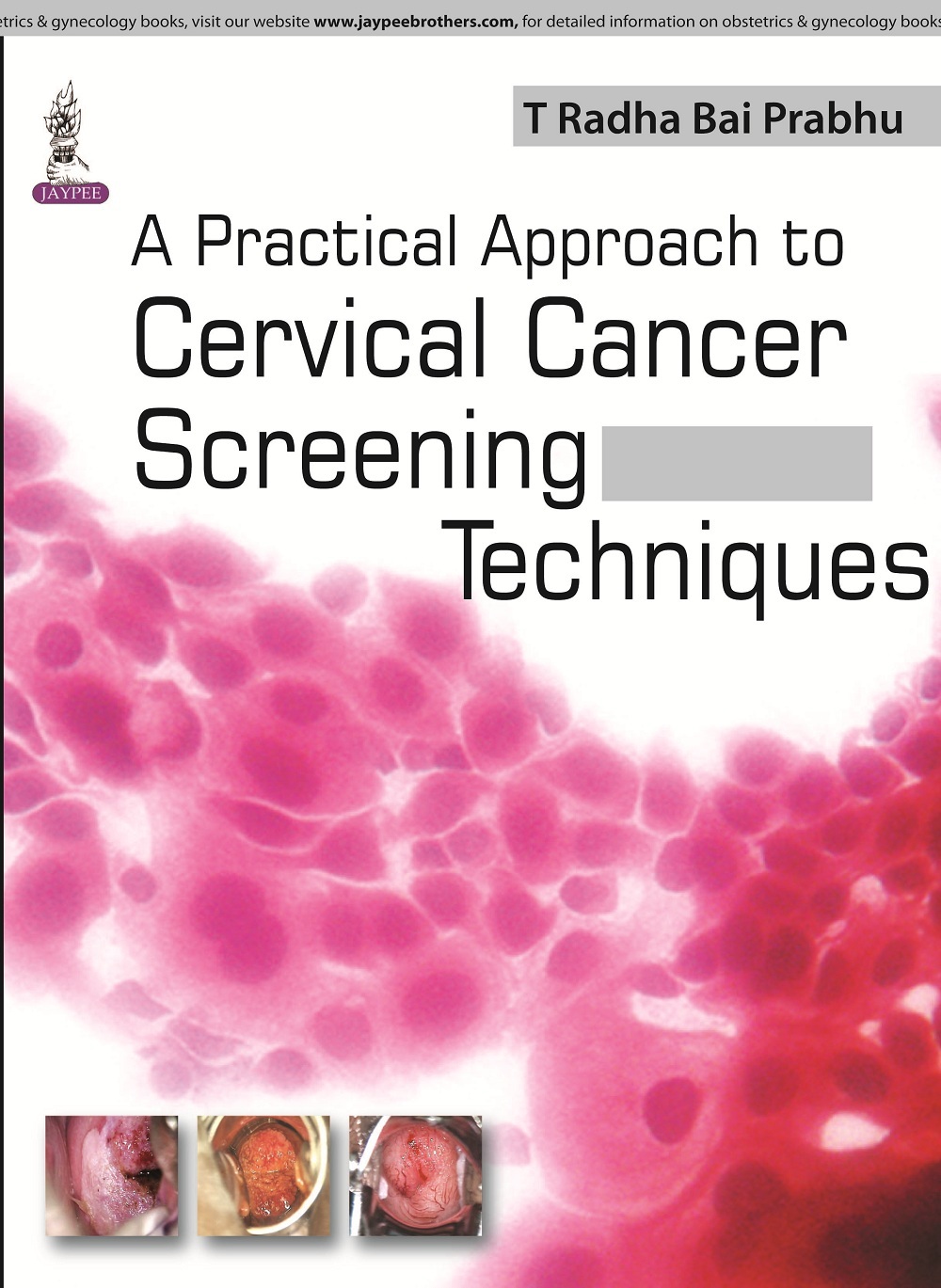 A Practical Approach to Cervical Cancer Screening Techniques by Prabhu ...