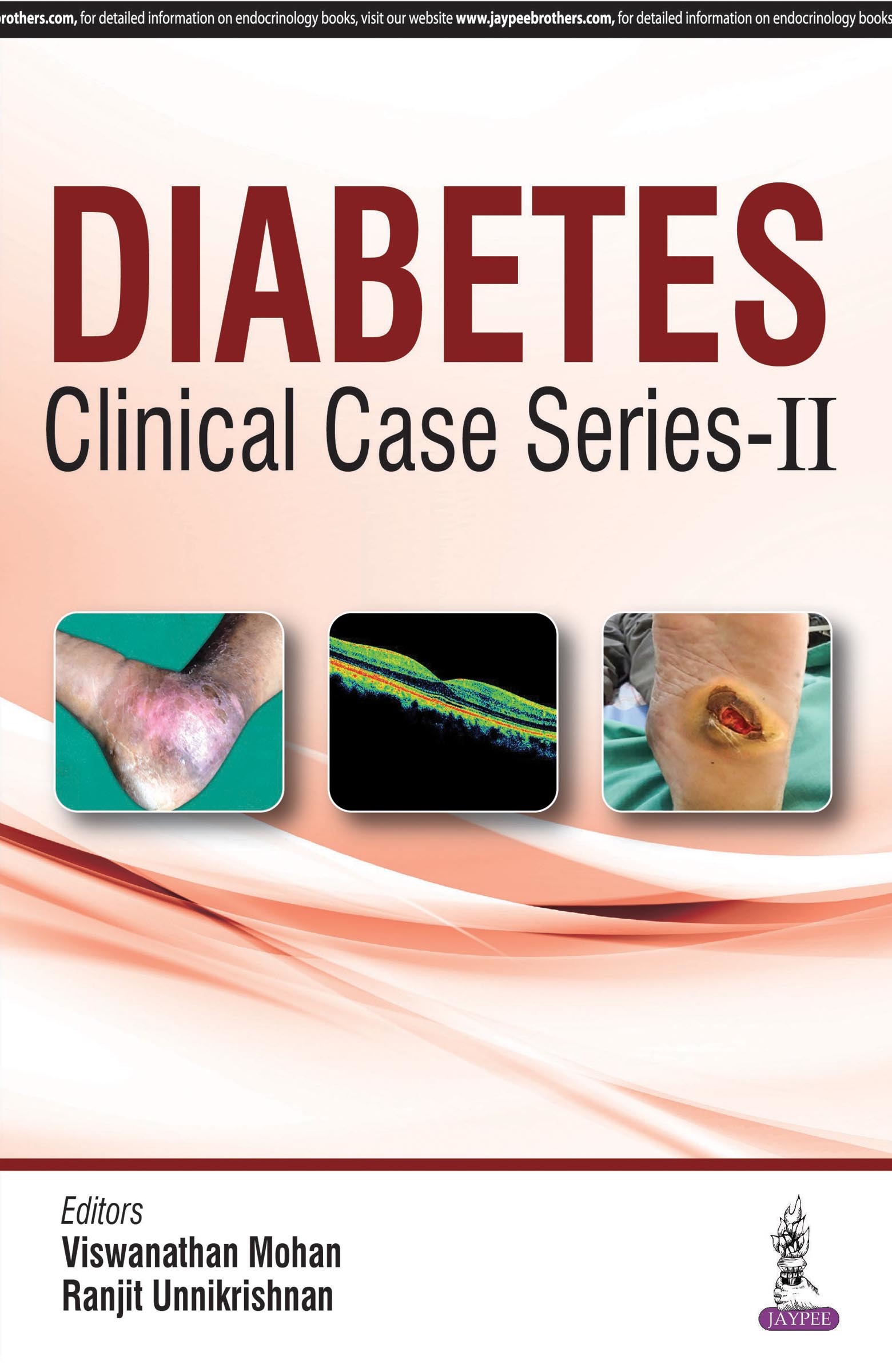 Diabetes Clinical Case Series – 2 by Mohan, Viswanathan (9789352702251 ...